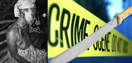 Liberia: Woman Allegedly Attacked With Cutlass by Boyfriend in Bong ...